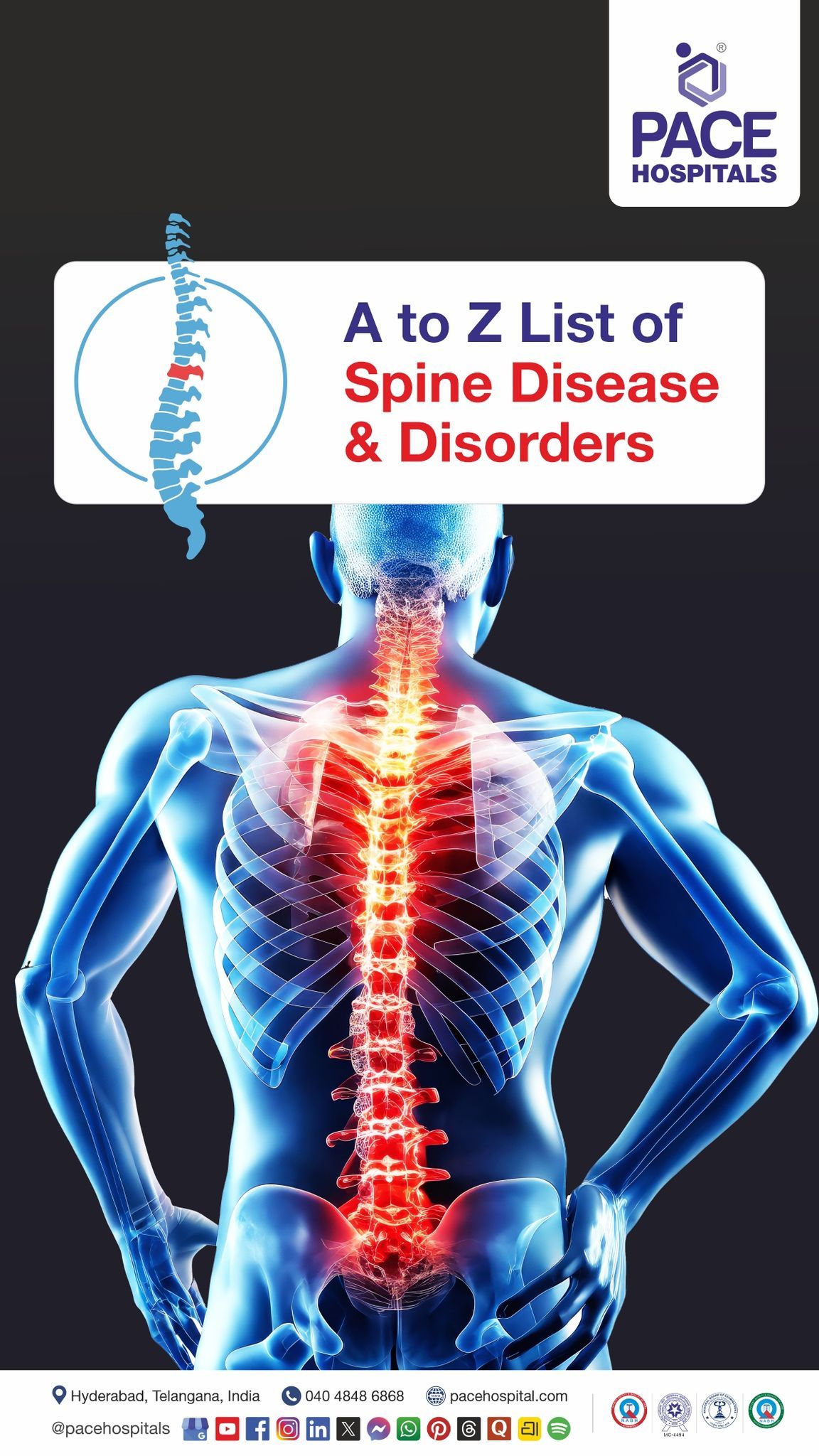 Spine Disorders List | Spine Disease Names - A to Z
