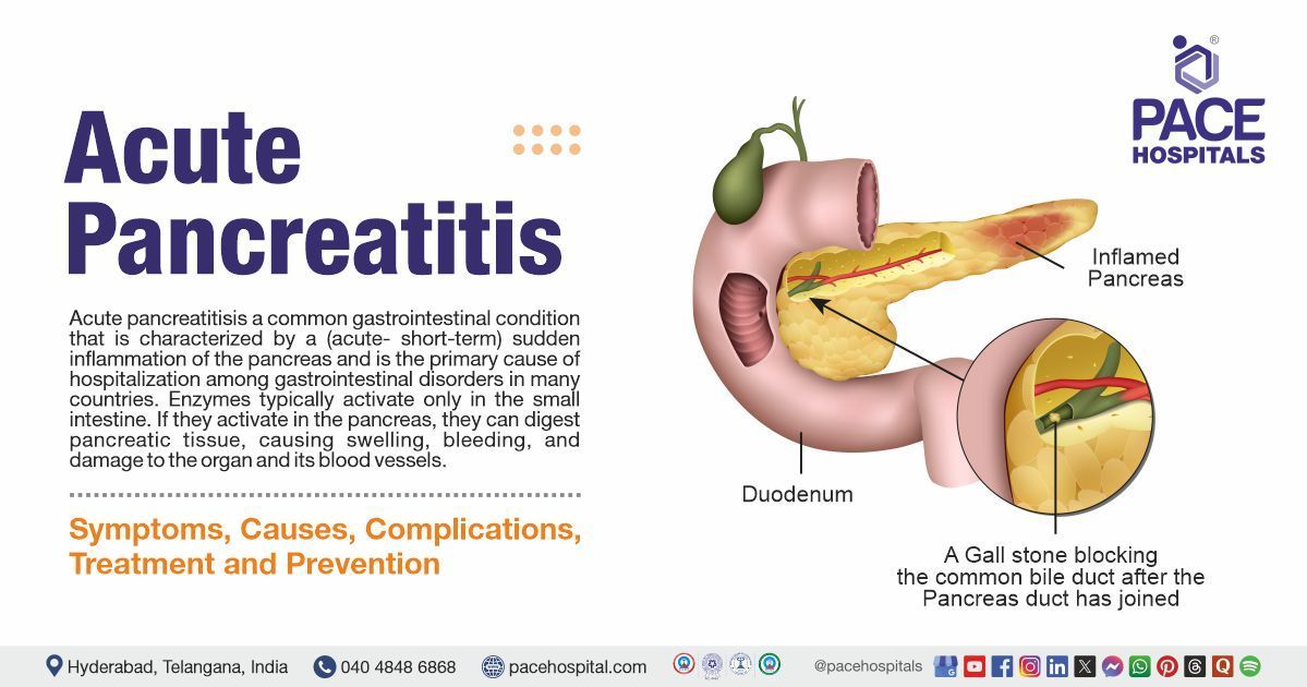 Acute Pancreatitis - Symptoms, Causes , Treatment & Prevention
