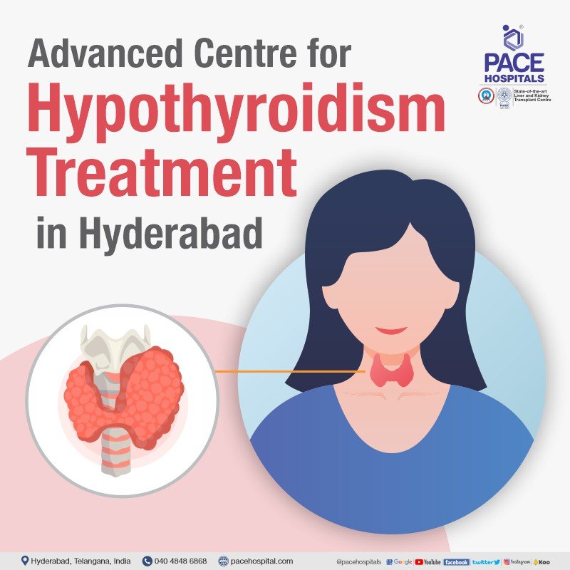 Best Hospital for Hypothyroidism Treatment in Hyderabad, Telangana