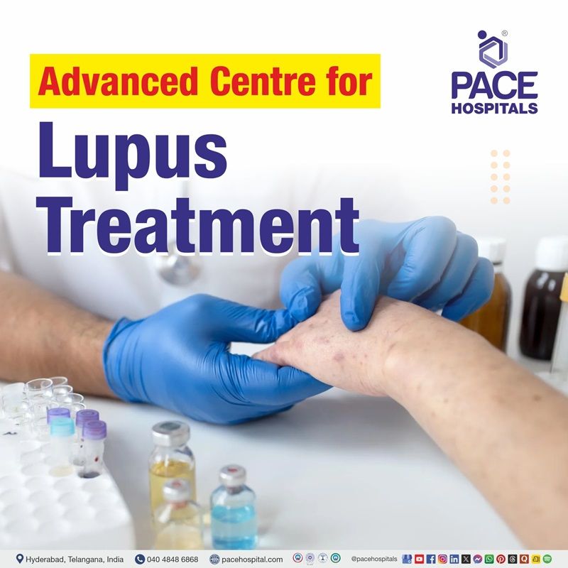 Best Hospital for Lupus Treatment in Hyderabad, India