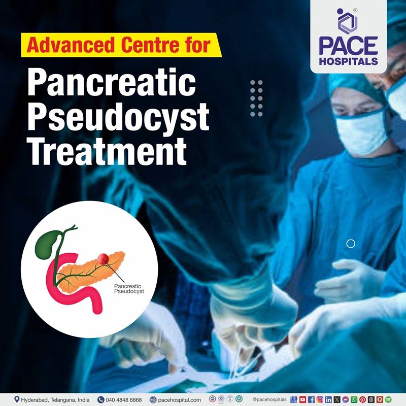 Best Hospital for Pancreatic Pseudocyst Treatment in Hyderabad