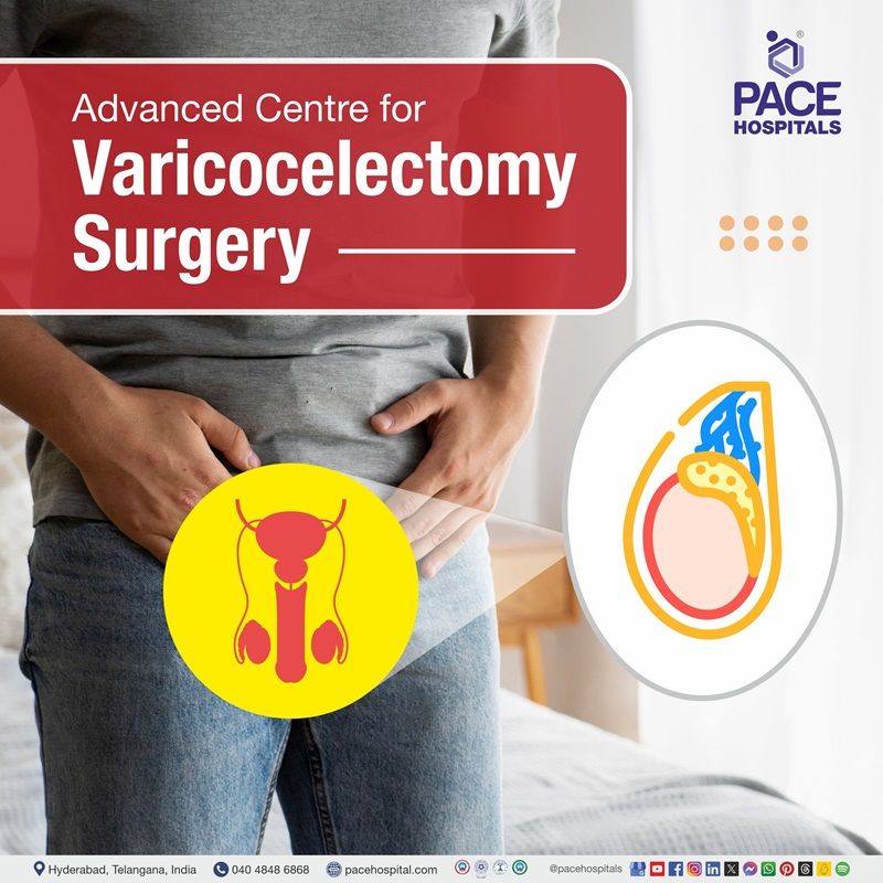 Best Varicocele Surgery in Hyderabad | Cost & Benefits