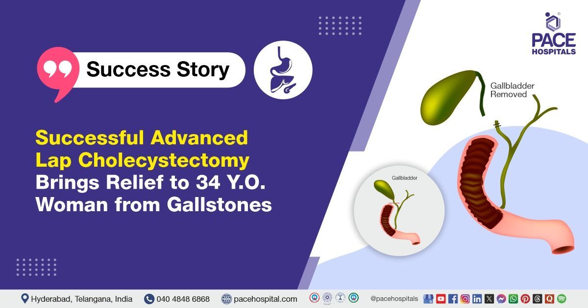 Successful Laparoscopic Cholecystectomy for Gallstones Treatment