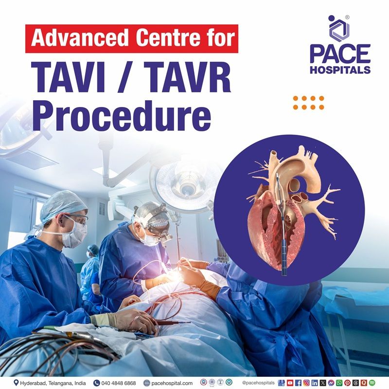 Best TAVI/TAVR Procedure in Hyderabad, India