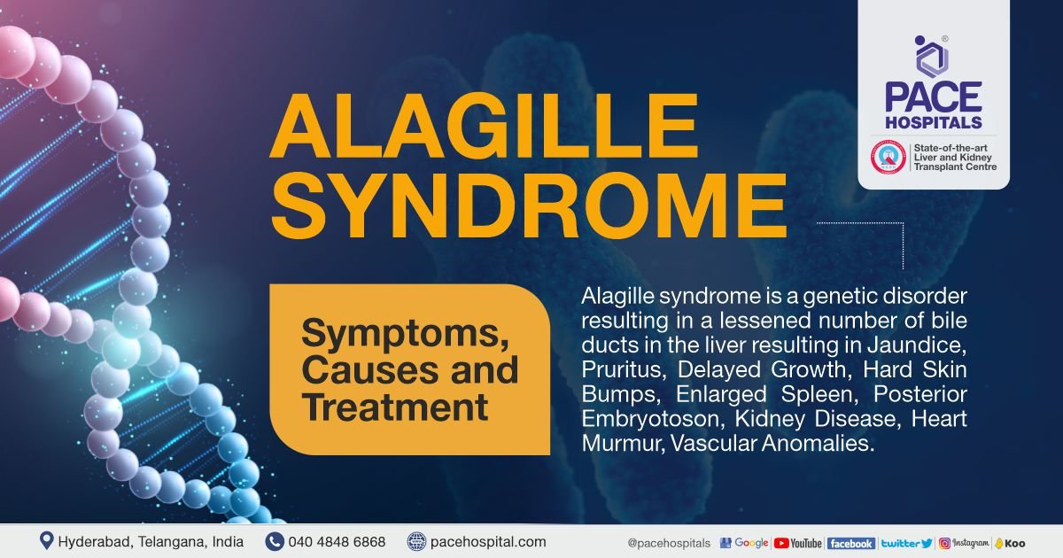 Alagille syndrome - Symptoms, Causes and Treatment