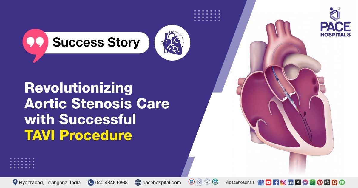 Successful TAVI Procedure for Severe Aortic Stenosis Treatment