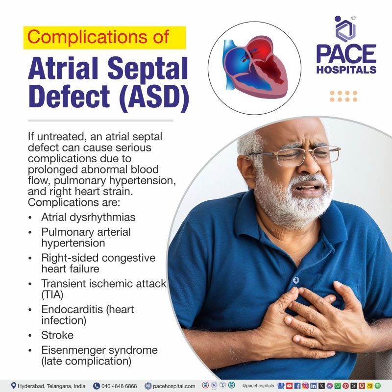 Atrial Septal Defect (ASD): Types, Symptoms, Causes & Treatment