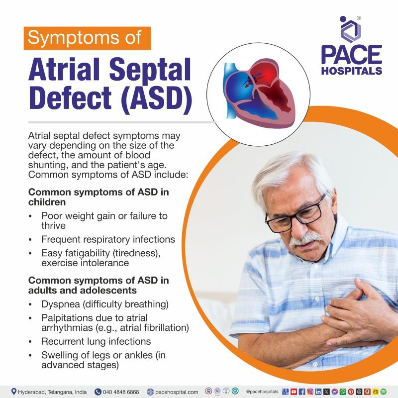 Atrial Septal Defect (ASD): Types, Symptoms, Causes & Treatment