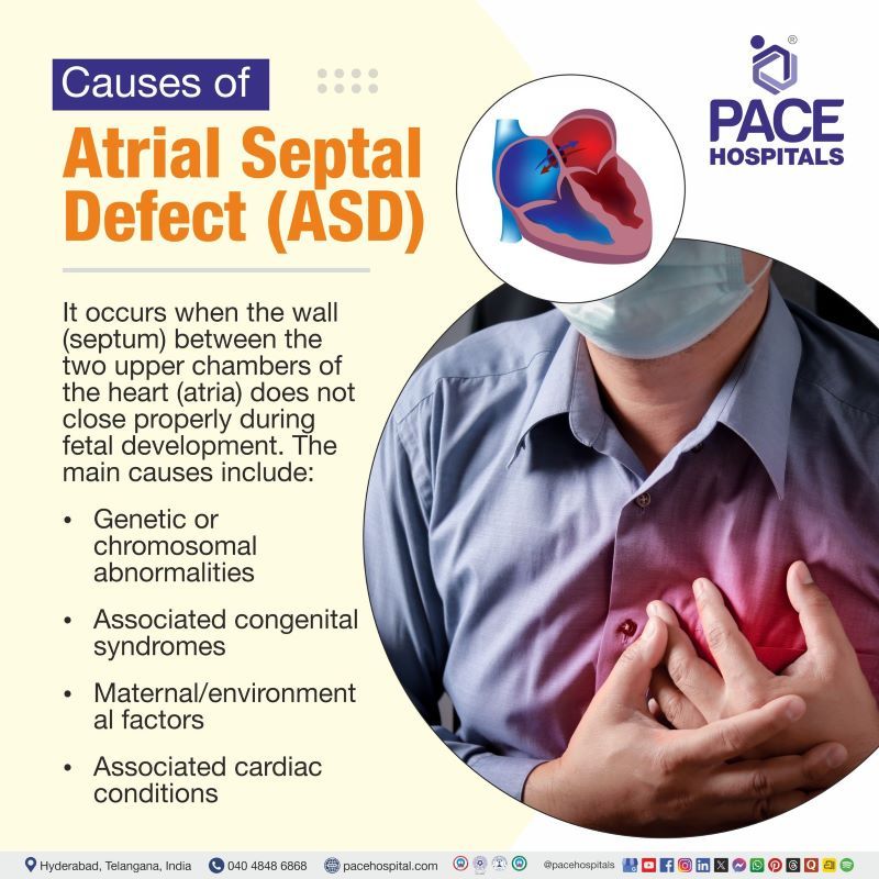 Atrial Septal Defect (ASD): Types, Symptoms, Causes & Treatment