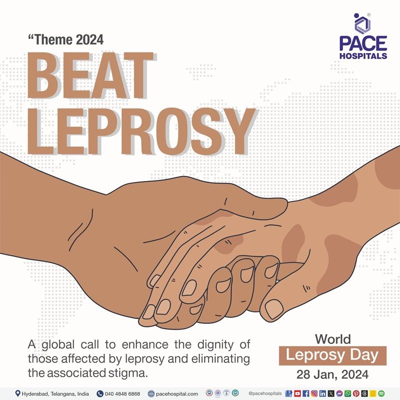 World Leprosy Day, 29 January 2024 - Theme, History & Importance