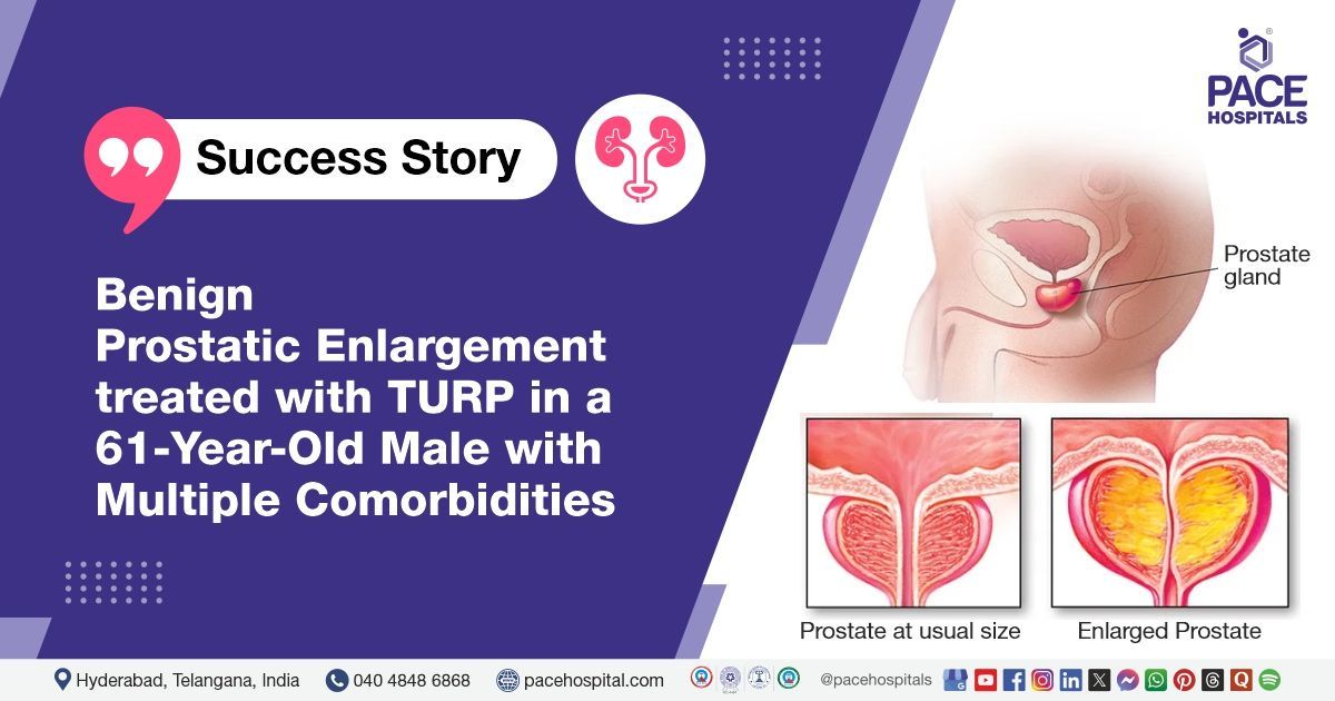 Successful TURP Surgery for Benign Prostatic Enlargement