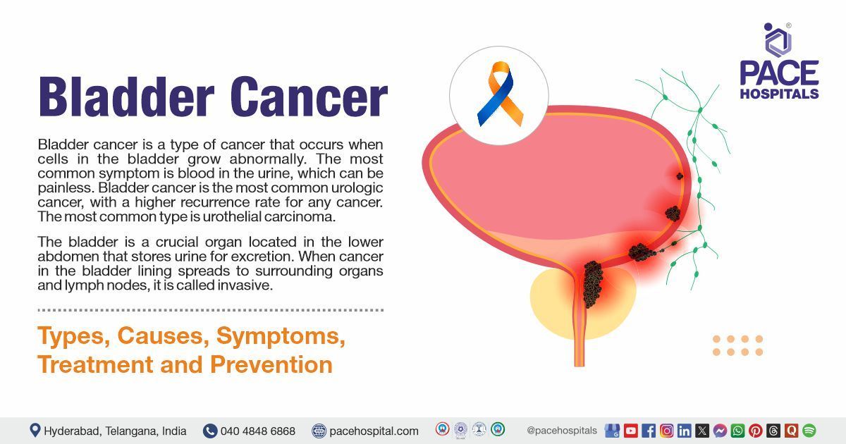 Bladder Cancer: Types, Causes, Symptoms, Diagnosis & Treatment