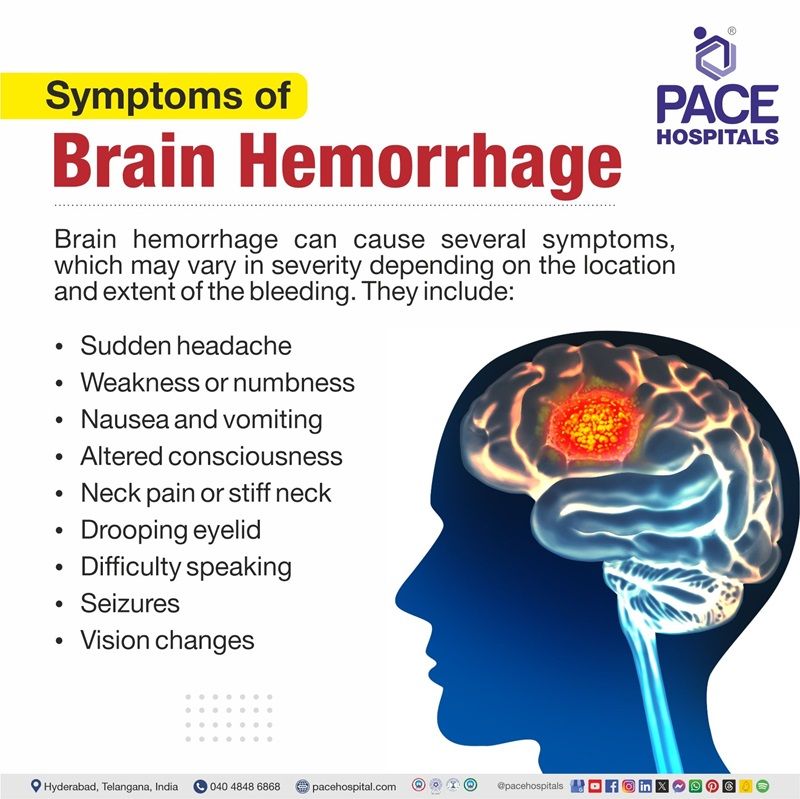 Brain Hemorrhage - Causes, Symptoms, Types, Treatment