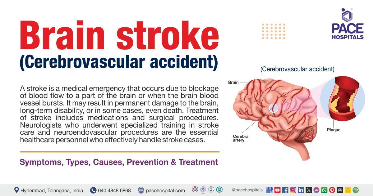 Stroke Brain