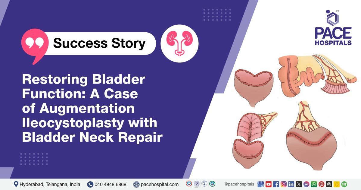 Cystoscopy & Augmentation Surgery for Urinary Incontinence Case