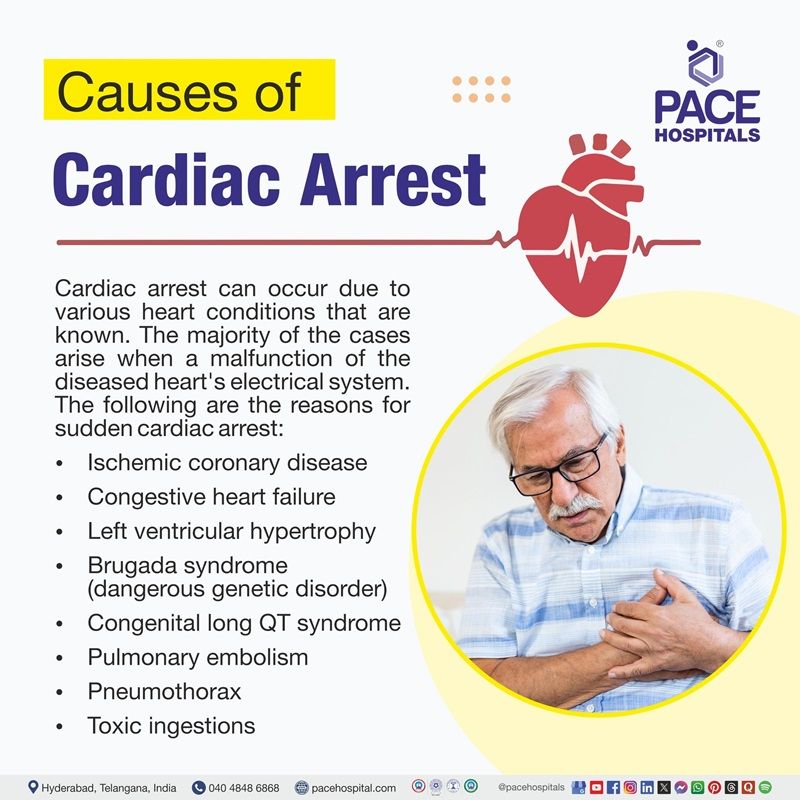 Cardiac Arrest: Symptoms, Causes, Treatment & Prevention