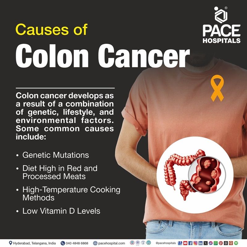 Colon Cancer: Types, Causes, Risk Factors, Symptoms & Treatment