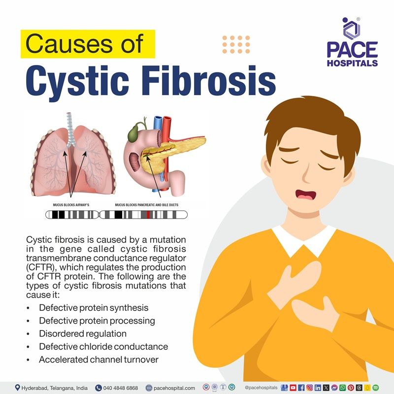Cystic Fibrosis - Symptoms, Causes, Treatment and Prevention