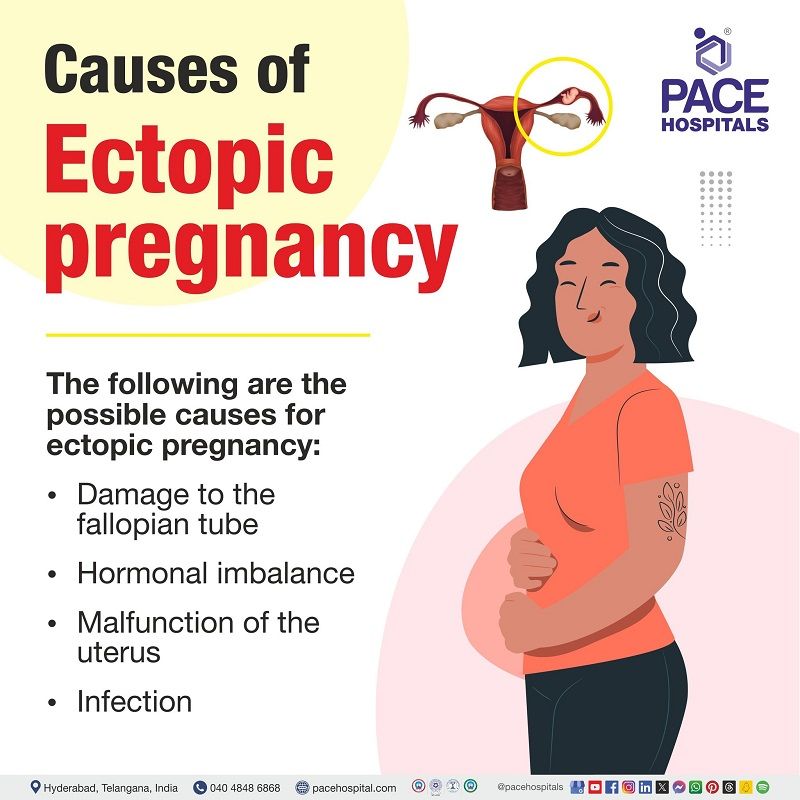 Ectopic Pregnancy: Causes, Symptoms, Types and Treatment