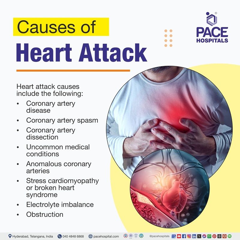 Heart Attack: Types, Symptoms, Causes, Treatment & Prevention