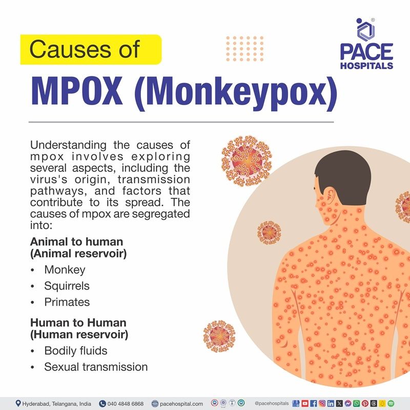 Mpox (monkeypox) - Symptoms, Causes, Treatment and Prevention