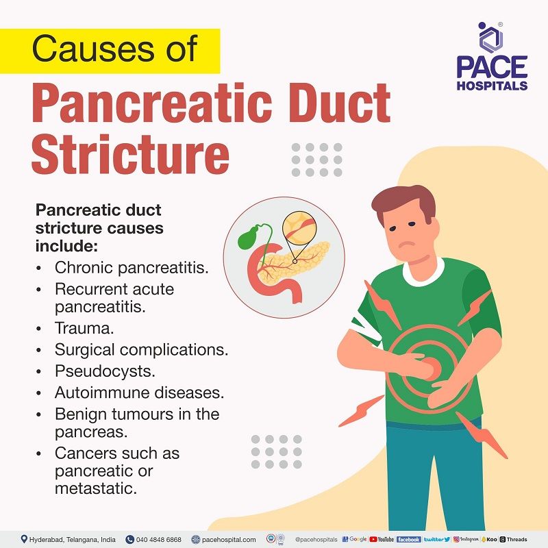 Pancreatic duct stricture: Symptoms, Causes, Complications