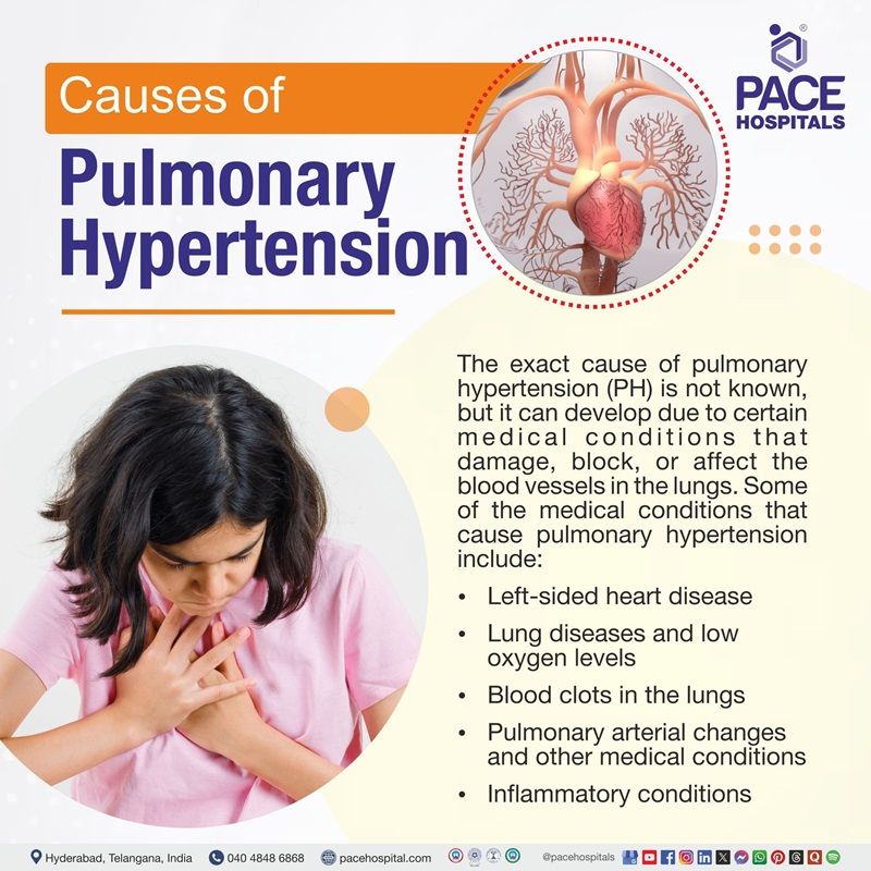 Pulmonary Hypertension - Symptoms, Causes, Diagnosis & Treatment
