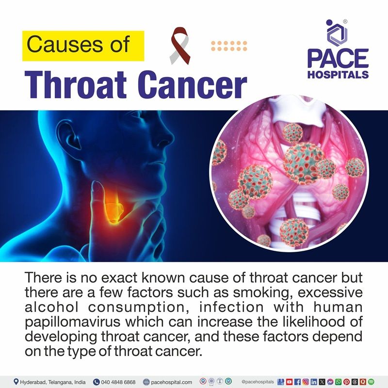 Throat Cancer: Symptoms, Causes, Types, Treatment & Prevention