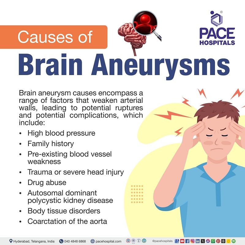 Brain aneurysm - Symptoms, Causes, Prevention and Treatment