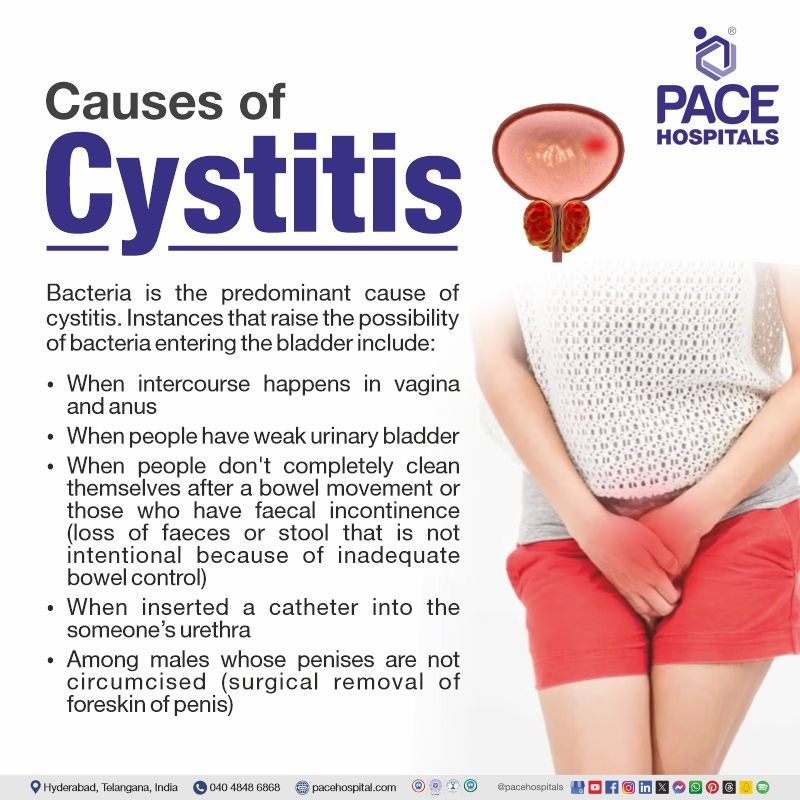Cystitis: Types, Symptoms, Causes, Prevention & Treatment