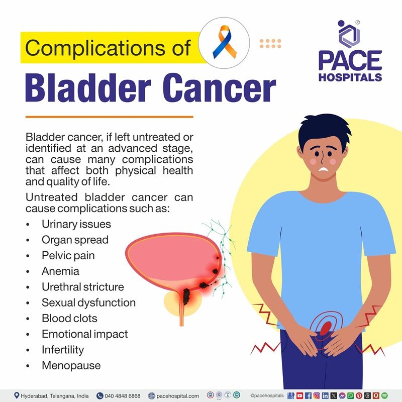 Bladder Cancer: Types, Causes, Symptoms, Diagnosis & Treatment