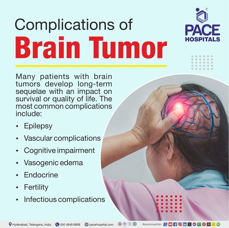 Brain Tumor - Symptoms, Causes, Prevention and Treatment