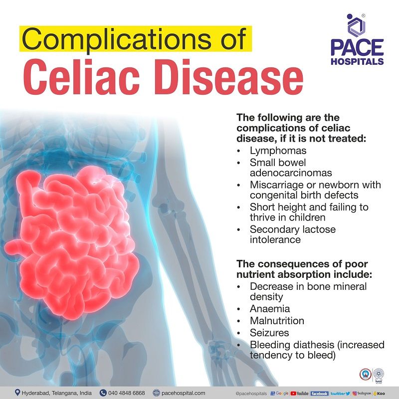 Celiac Disease: Symptoms, Causes, Risks & Complications