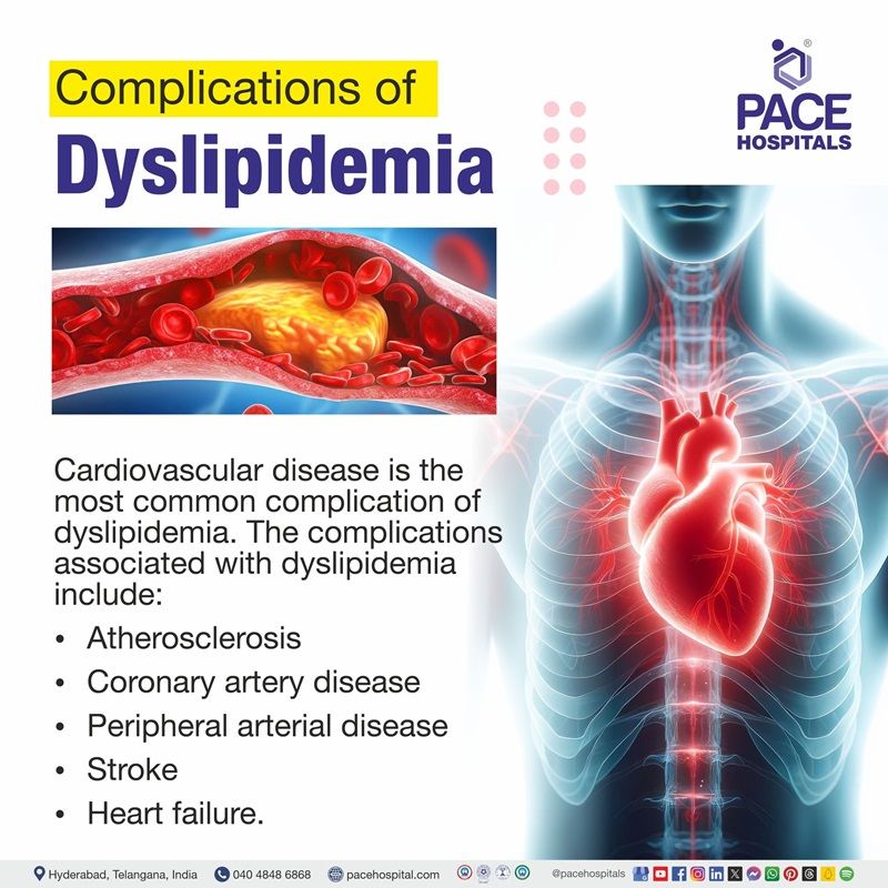 Dyslipidemia - Symptoms, Causes, Diagnosis and Treatment
