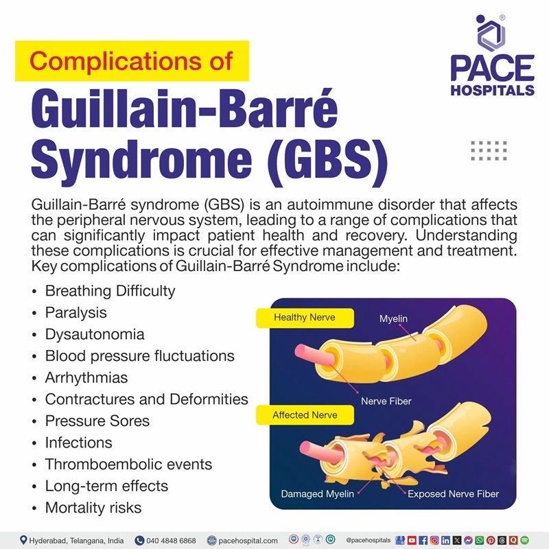 Guillain-Barré syndrome: Types, Symptoms, Causes & Treatment