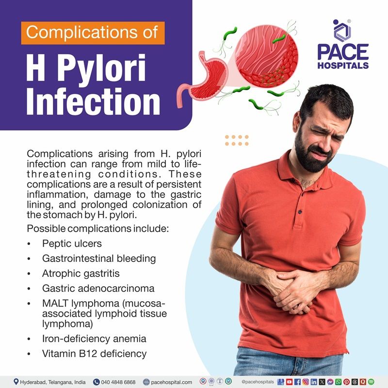 H. Pylori - Symptoms, Test, Causes, Treatment & Prevention