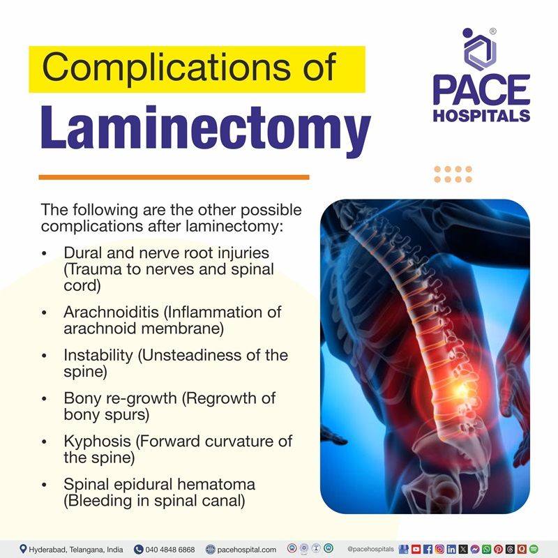 Best Laminectomy Surgery in Hyderabad, India - Spinal Decompression
