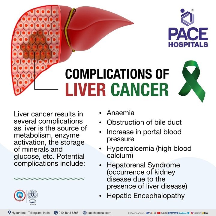 Liver Cancer - Symptoms, Causes, Types, Complications, Prevention