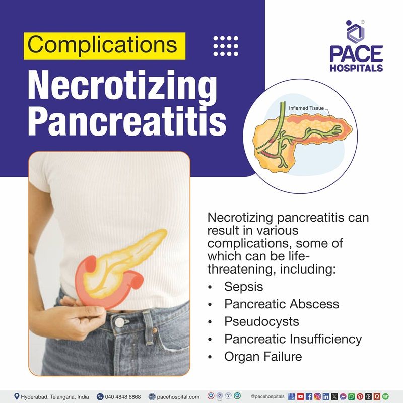 Necrotizing Pancreatitis: Causes, Symptoms, Diagnosis, Treatment