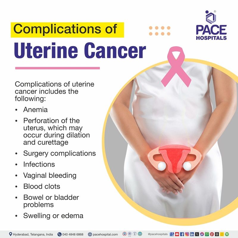 Uterine Cancer – Symptoms, Causes, Types, Diagnosis & Treatment