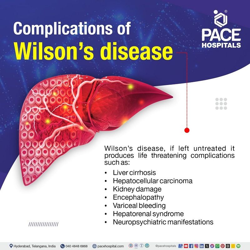 Wilson’s Disease - Symptoms, Causes, Prevention, and Treatment