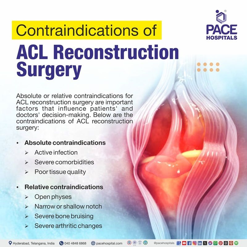 Best Hospital for ACL Surgery in Hyderabad | Cost & Success Rate