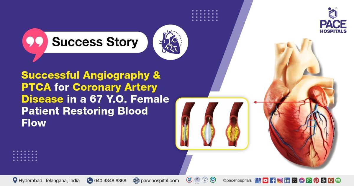 Angiography & PTCA for Coronary Artery Disease (CAD) Treatment