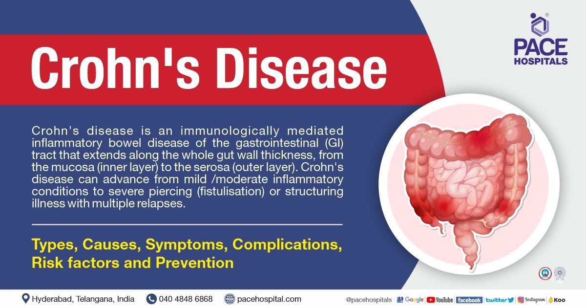 Crohn s Disease Symptoms Causes Complications Prevention 50 OFF