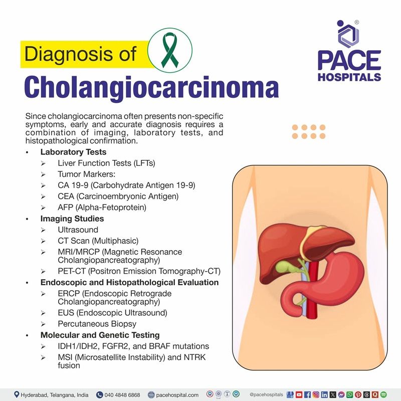 Cholangiocarcinoma: Symptoms, Causes, Types, Staging & Treatment