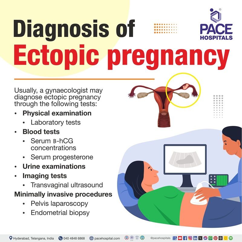 Best Hospital for Ectopic Pregnancy Treatment in Hyderabad, India