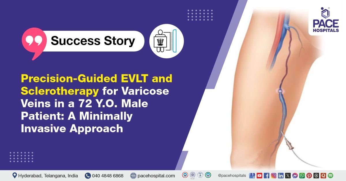Successful Varicose Veins Treatment with EVLT and Sclerotherapy