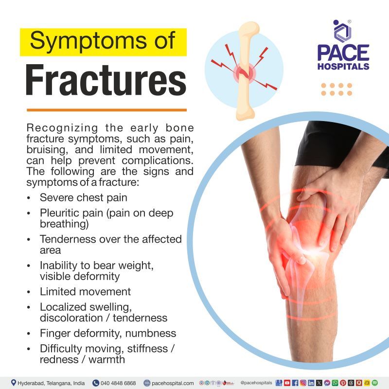Fractures: Symptoms, Causes, Types & Treatment