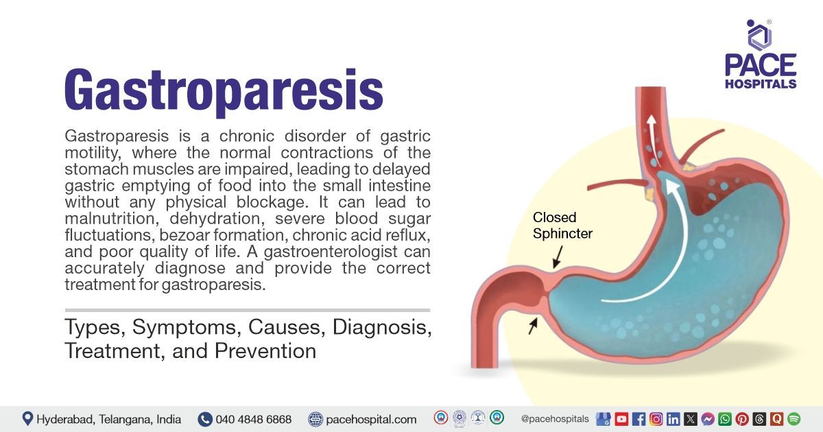 Gastroparesis: Symptoms, Causes, Diagnosis, Treatment, Prevention