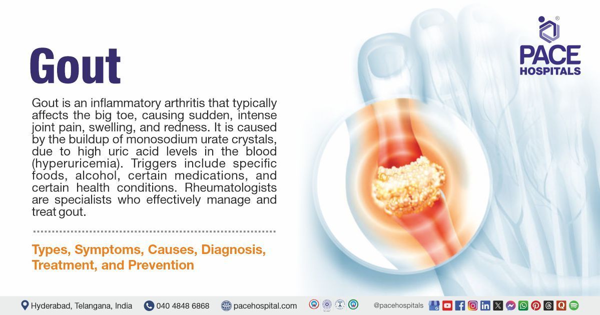 Gout – Symptoms, Causes, Diagnosis, Treatment & Prevention